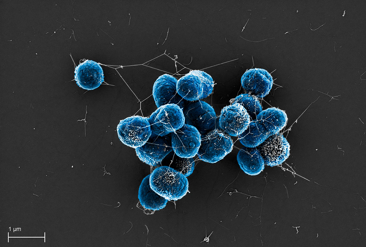 WP3: Cold-Loving Microbes in a Warming Arctic - CAGE, Centre for Arctic ...